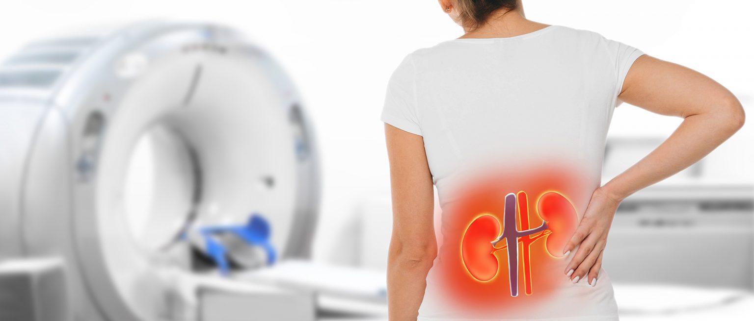 Signs of Kidney Failure - Beaumont Emergency Hospital