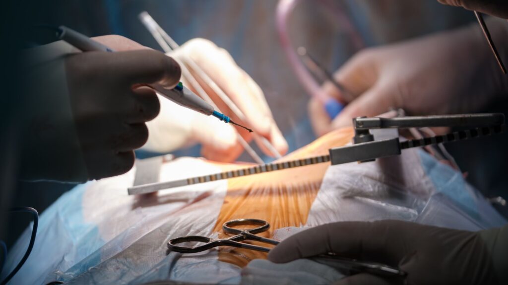 Infected Surgical Incision - Beaumont Emergency Hospital